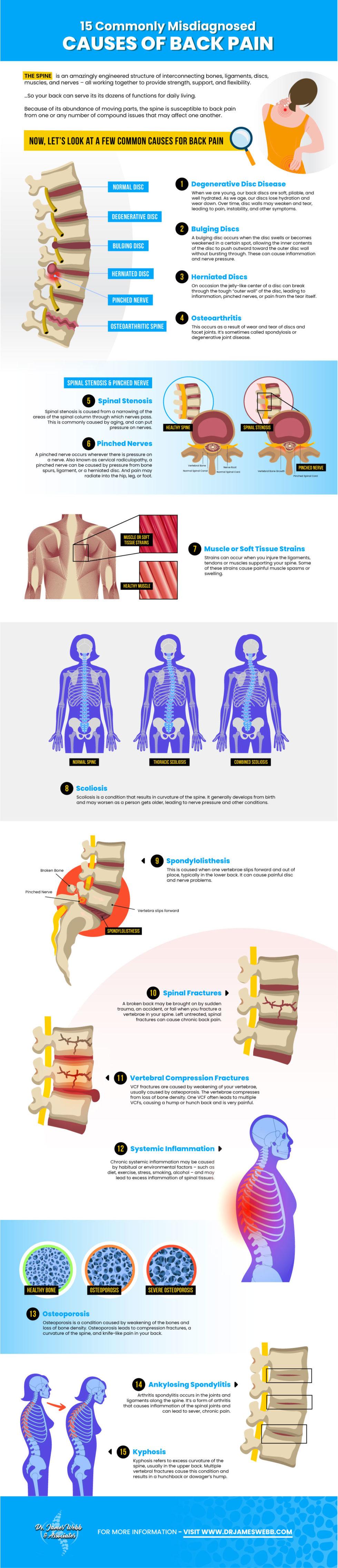 15 Commonly Misdiagnosed Causes of Back Pain Infographic - Dr. James Webb